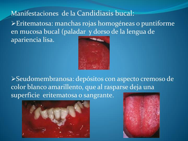PPT - Asepsia y Antisepsia PowerPoint Presentation - ID:2152174