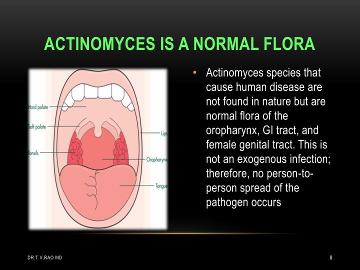 PPT - ACTINOMYCOSIS PowerPoint Presentation - ID:2152211