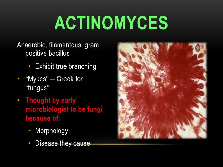 PPT - ACTINOMYCOSIS PowerPoint Presentation - ID:2152211
