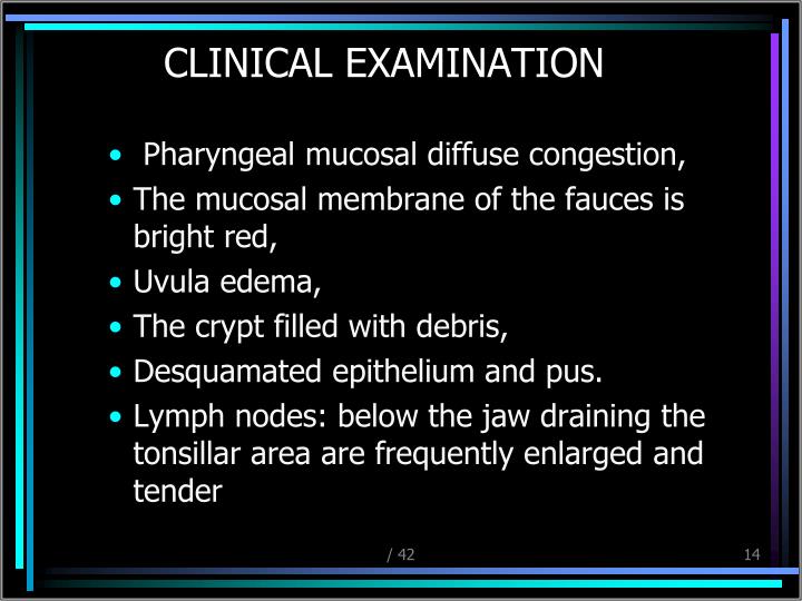 PPT - TONSILLITIS PowerPoint Presentation - ID:2152783