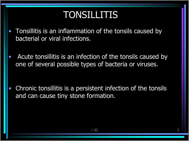 PPT - TONSILLITIS PowerPoint Presentation - ID:2152783