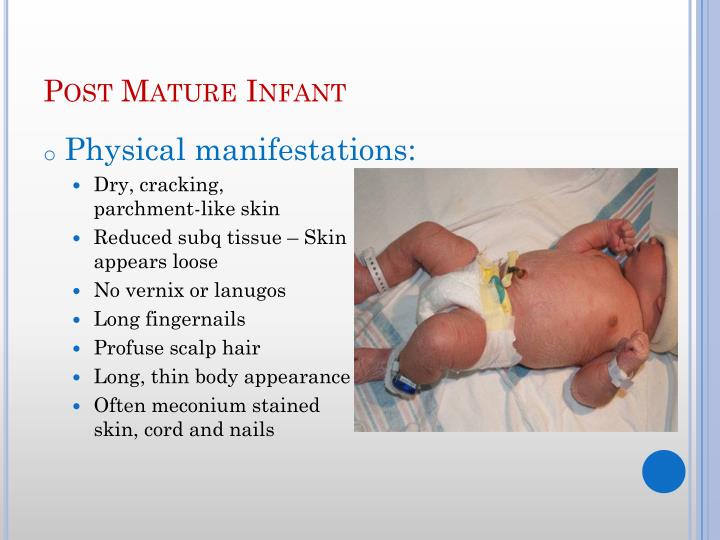 PPT - High Risk Neonates PowerPoint Presentation - ID:2152872