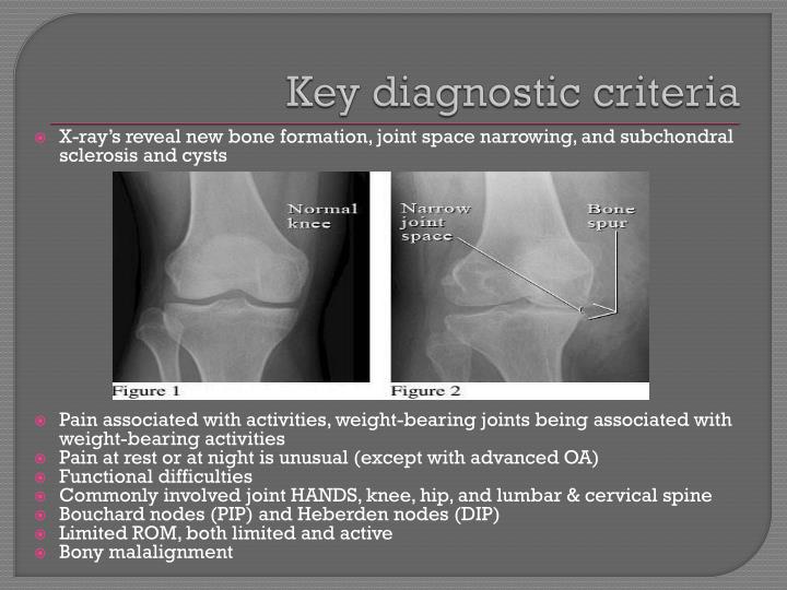 PPT - Paget Disease PowerPoint Presentation - ID:2153842