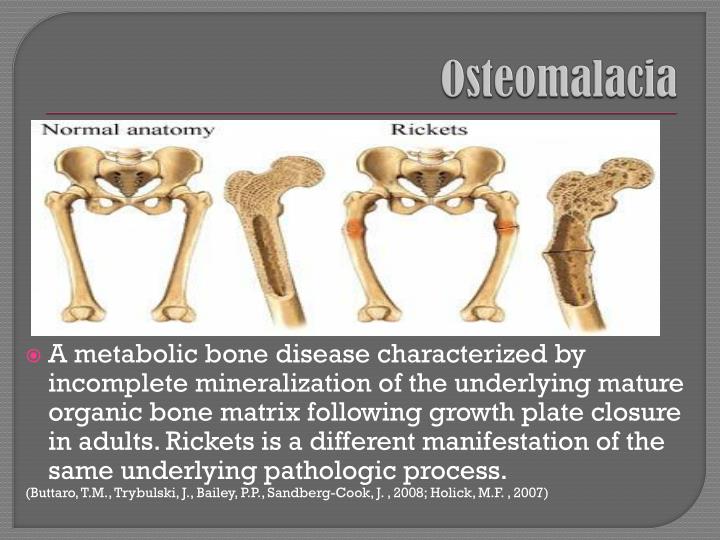 PPT - Paget Disease PowerPoint Presentation - ID:2153842