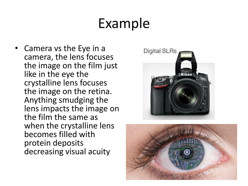 PPT - Cataract Surgery & Premium IOLs PowerPoint Presentation, free ...