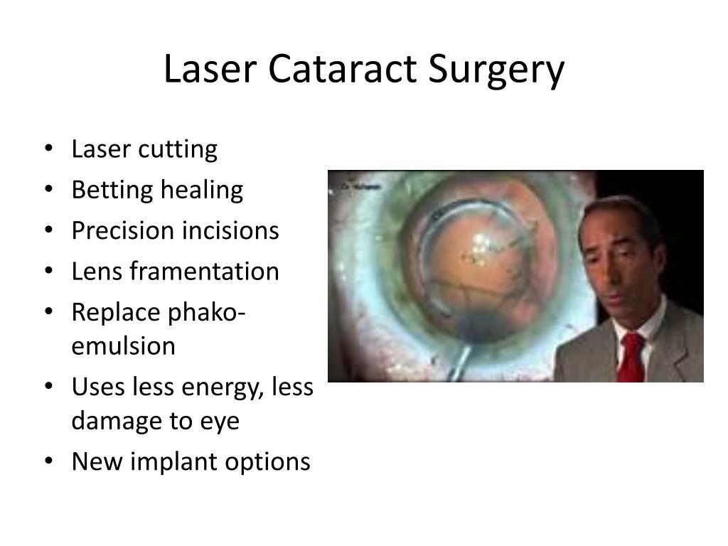 PPT - Cataract Surgery & Premium IOLs PowerPoint Presentation, free ...