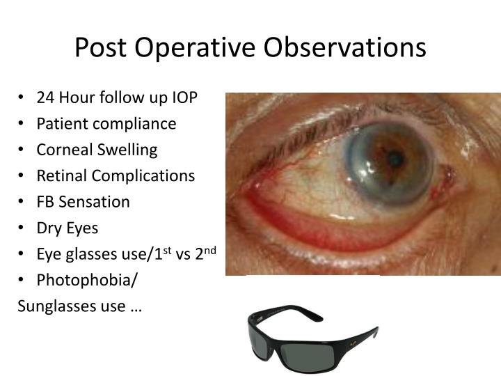 PPT - Cataract Surgery & Premium IOLs PowerPoint Presentation - ID:2155016