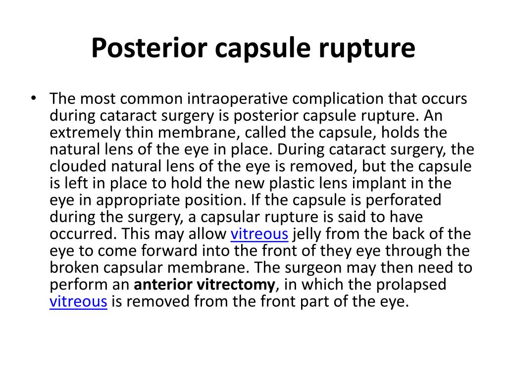 PPT - Cataract Surgery & Premium IOLs PowerPoint Presentation, free ...