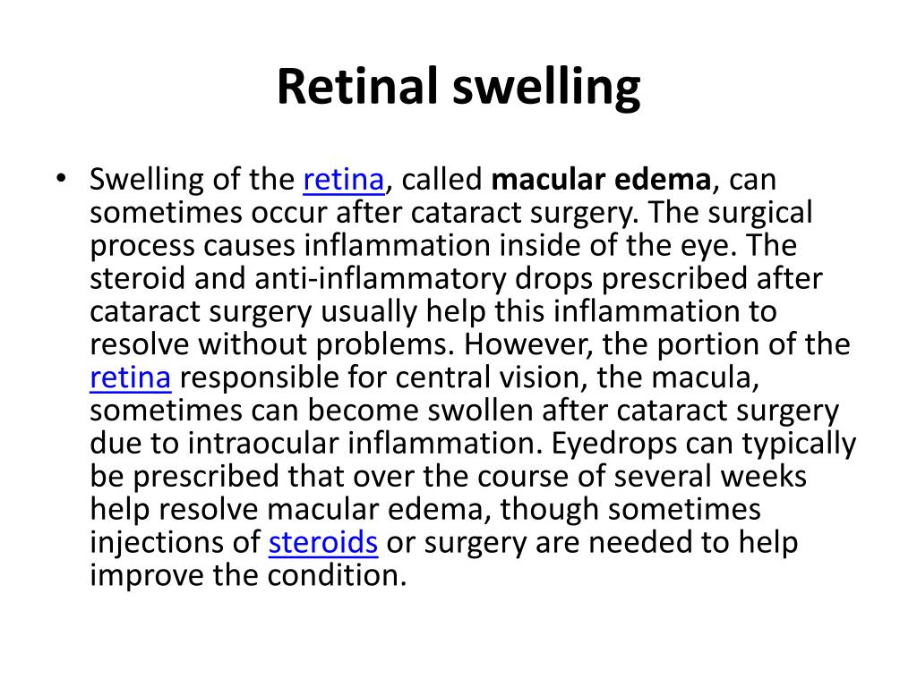 PPT - Cataract Surgery & Premium IOLs PowerPoint Presentation, free ...
