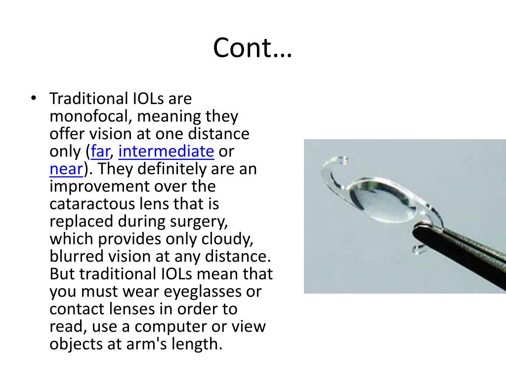 PPT - Cataract Surgery & Premium IOLs PowerPoint Presentation, free ...
