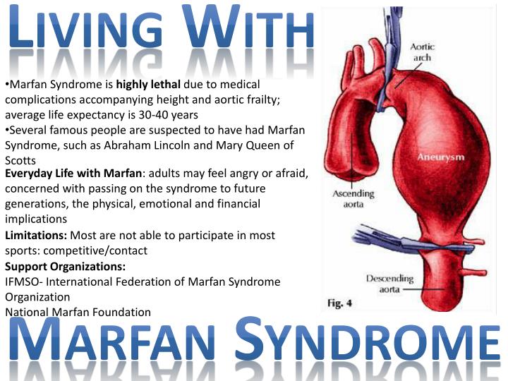 PPT - Marfan PowerPoint Presentation - ID:2155406