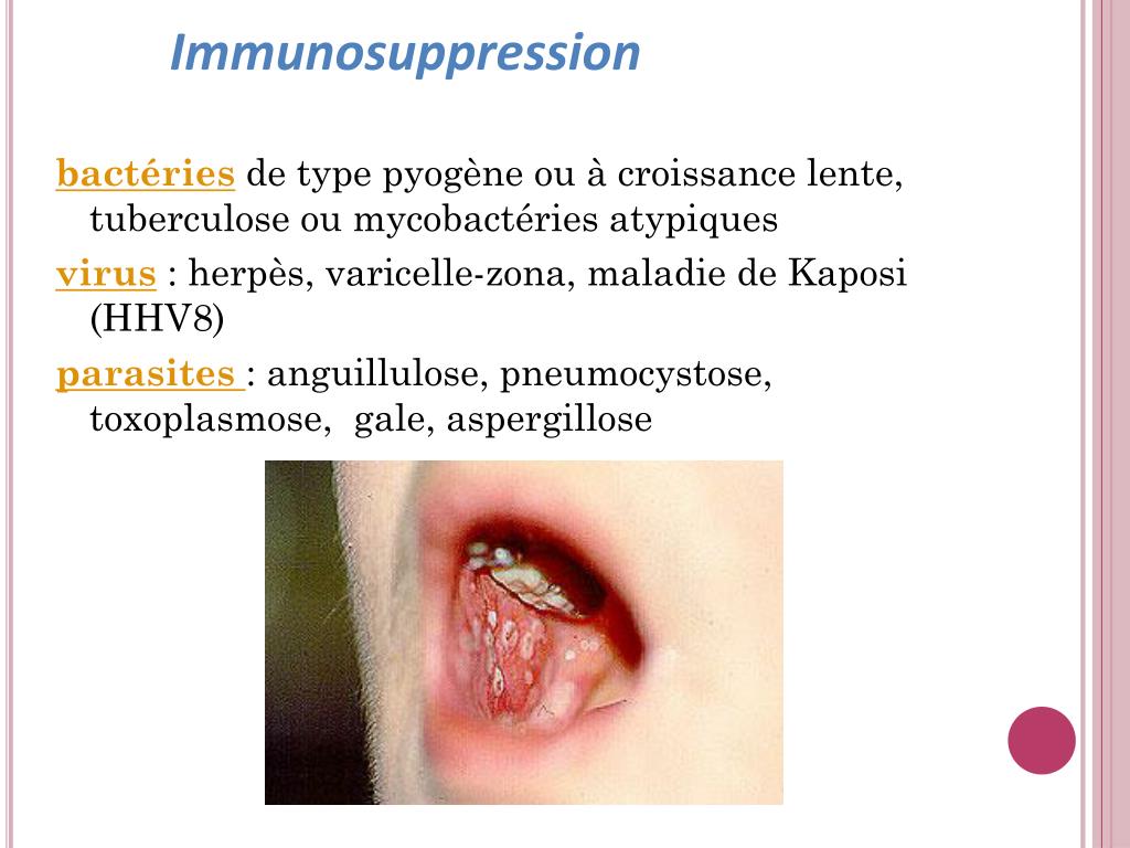 PPT - LES Anti-inflammatoires stéroïdiens PowerPoint Presentation, free ...
