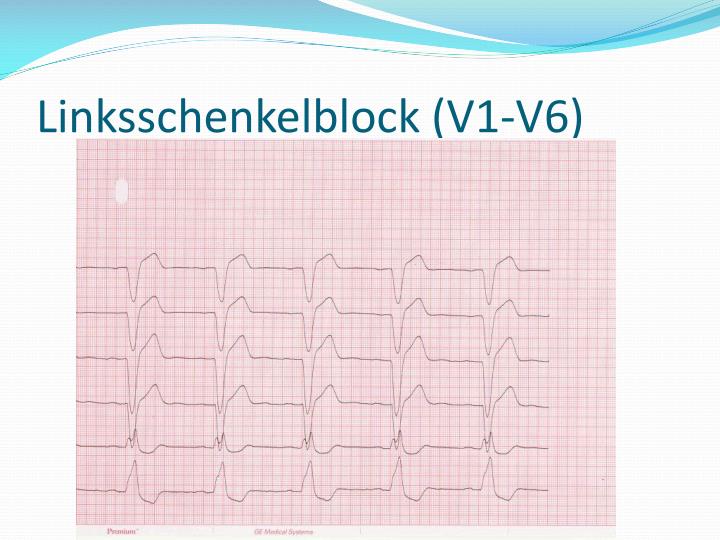 PPT - EKG-Kurs PowerPoint Presentation - ID:2156658