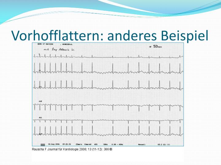 PPT - EKG-Kurs PowerPoint Presentation - ID:2156658