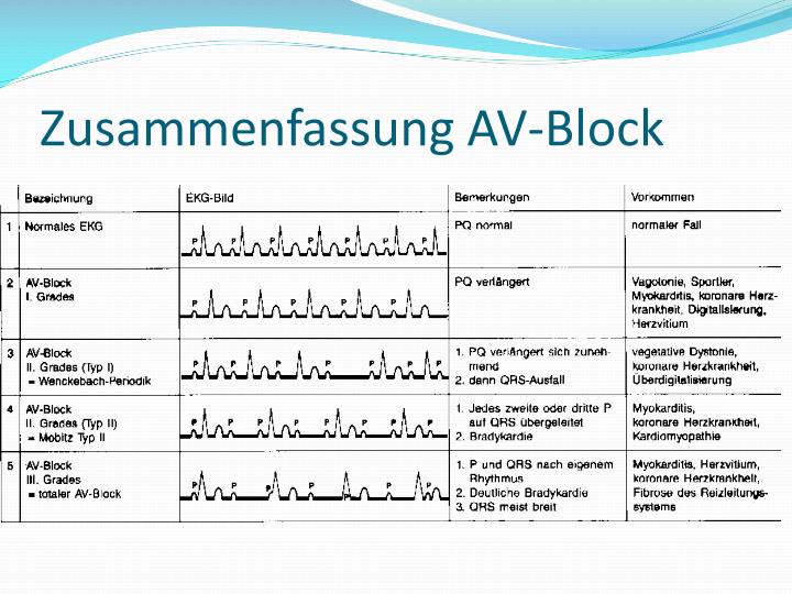 PPT - EKG-Kurs PowerPoint Presentation - ID:2156658