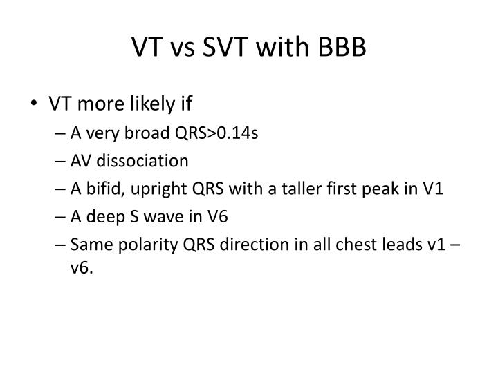 PPT - Ventricular Tachycardia PowerPoint Presentation - ID:2156853