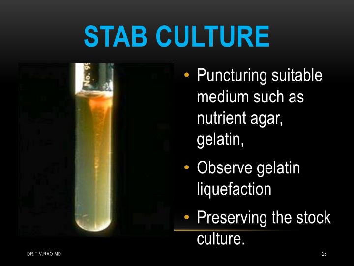 PPT - bacterial Culture methods BASICS PowerPoint Presentation - ID:2157627