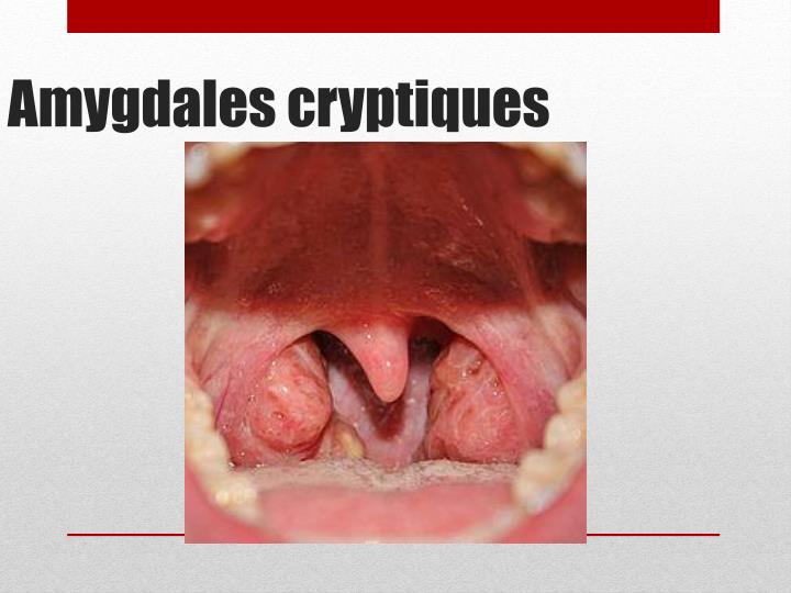 PPT - Amygdales cryptiques PowerPoint Presentation - ID:2157706