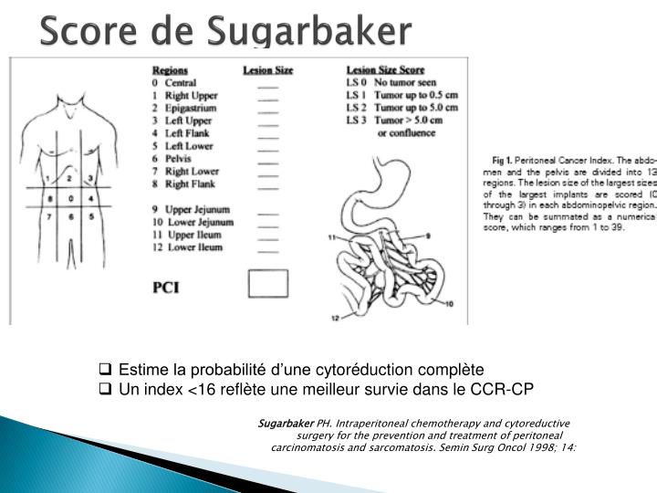 PPT - Carcinose péritonéale PowerPoint Presentation - ID:2158052