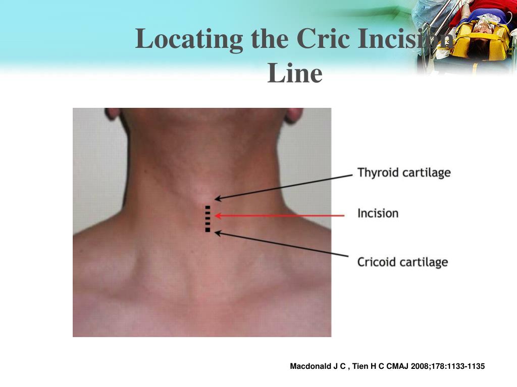 PPT - Prehospital Care of the Trauma Patient (Triage) PowerPoint ...