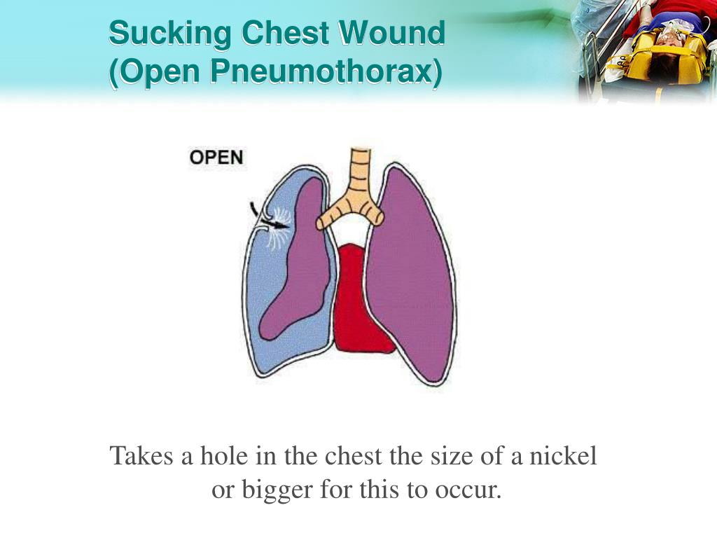 PPT - Prehospital Care of the Trauma Patient (Triage) PowerPoint ...