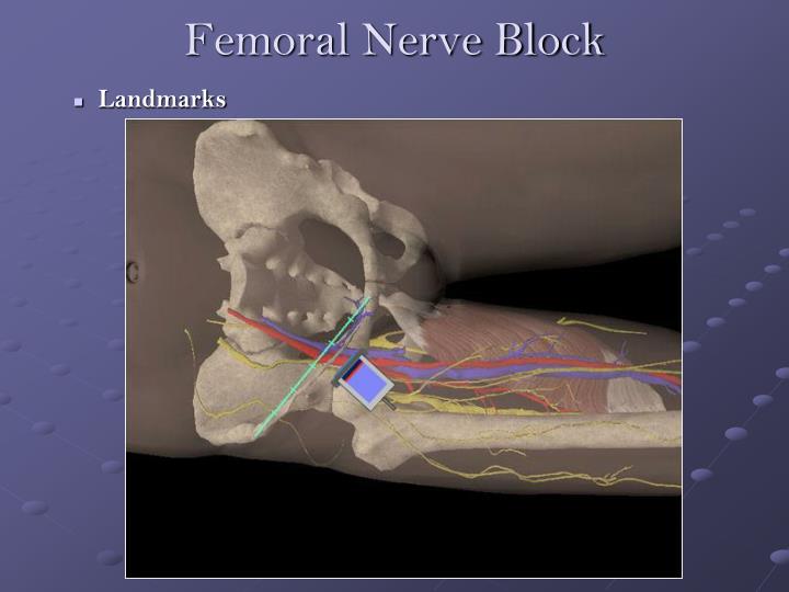 PPT - Lower Extremity and Trunk Ultrasound Guided Blocks PowerPoint ...