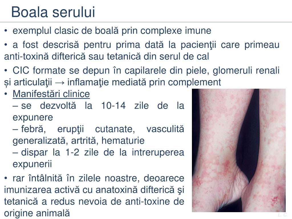 PPT - REACŢIILE DE HIPERSENSIBILITATE ( continuare ) PowerPoint ...