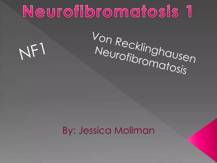PPT - Neurofibromatosis 1 PowerPoint Presentation, free download - ID:2160011