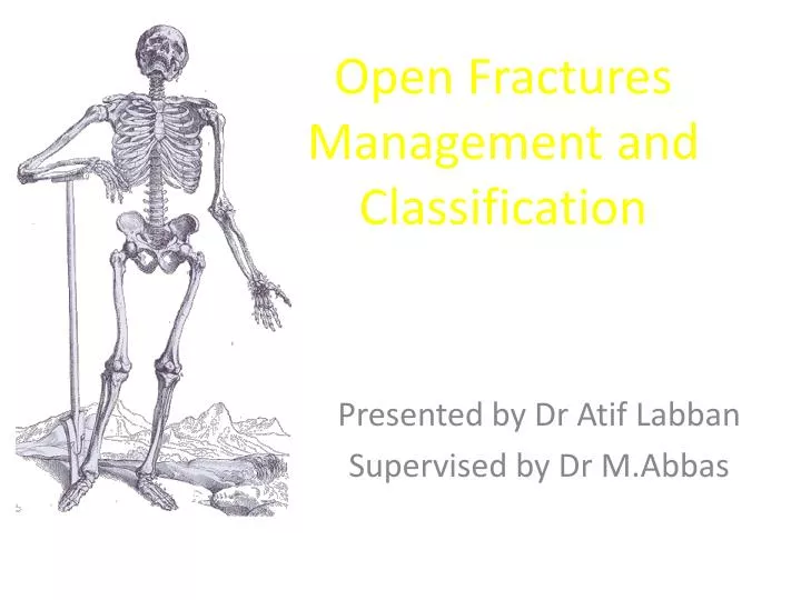PPT - Open Fractures Management and Classification PowerPoint ...