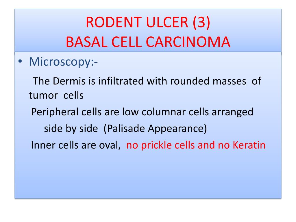 Ppt Skin Tumours Powerpoint Presentation Free Download Id 2160396