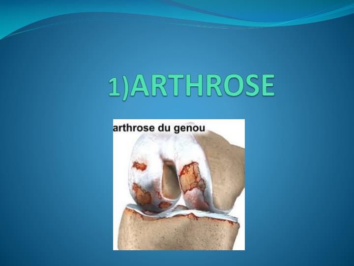 PPT - Douleurs du genou Orientation diagnostique Solutions ...