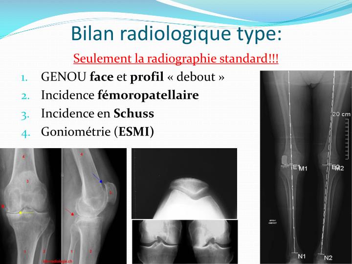 PPT - Douleurs du genou Orientation diagnostique Solutions ...