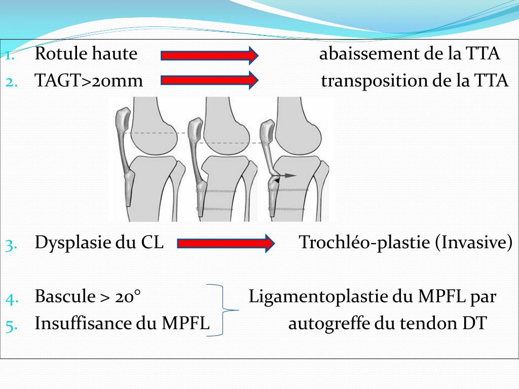 PPT - Douleurs du genou Orientation diagnostique Solutions ...