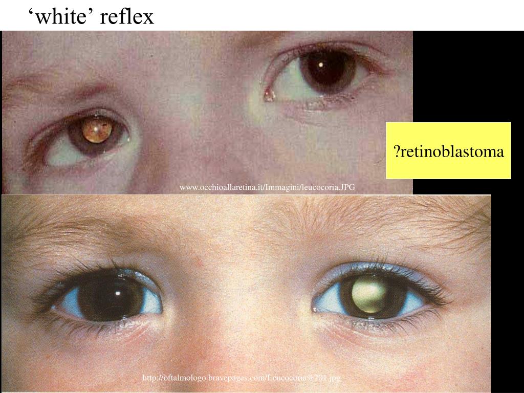 PPT - None-urgent eye problems David Kinshuck, associate specialist ...