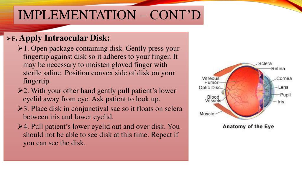 PPT - NUR 113: SKILL 21-4 INSTILLING EYE & EAR MEDICATIONS PowerPoint ...