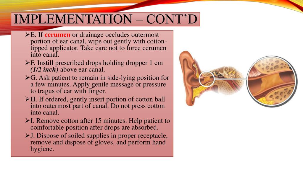 PPT - NUR 113: SKILL 21-4 INSTILLING EYE & EAR MEDICATIONS PowerPoint Presentation - ID:2161594