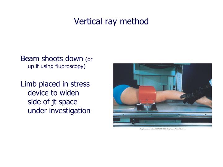 PPT - What is contrast arthrography? PowerPoint Presentation - ID:2161648