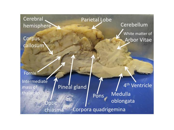 PPT - Lab 12 Sheep Brain Dissection PowerPoint Presentation - ID:2162022