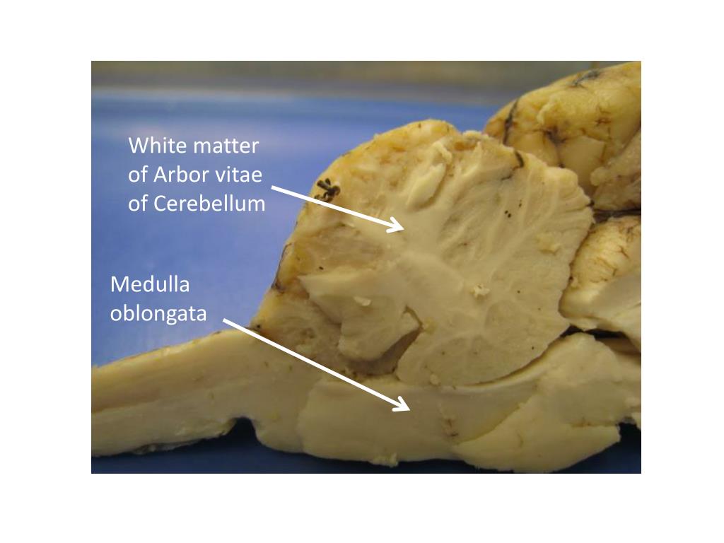 PPT - Lab 12 Sheep Brain Dissection PowerPoint Presentation, free ... PPT - Lab 12 Sheep Brain Dissection PowerPoint Presentation, free ...