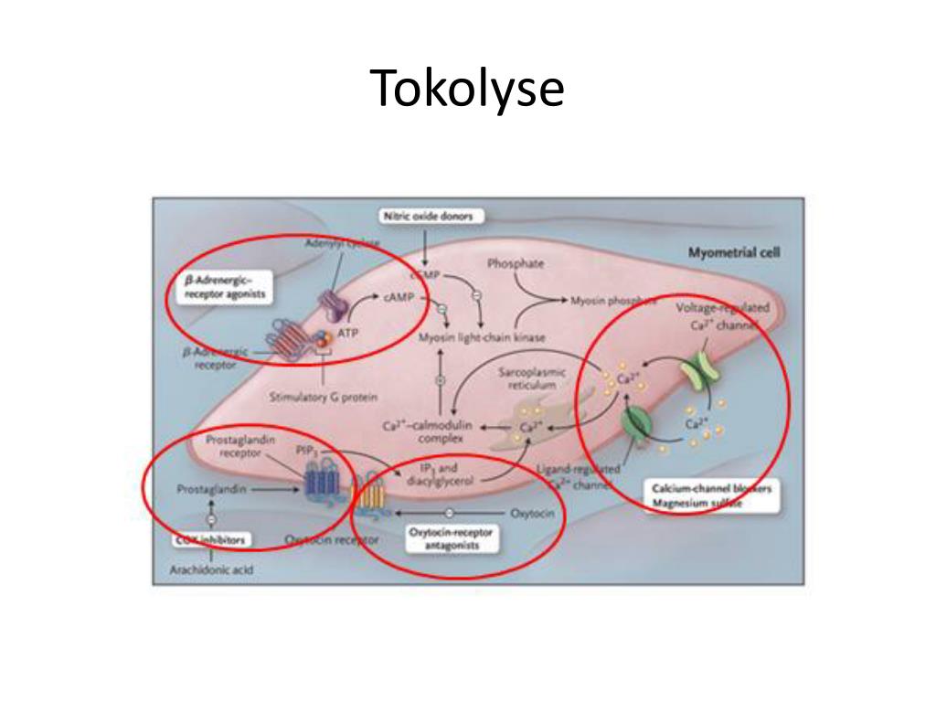 PPT - „Leitlinien“ zum Management der Frühgeburt PowerPoint ...