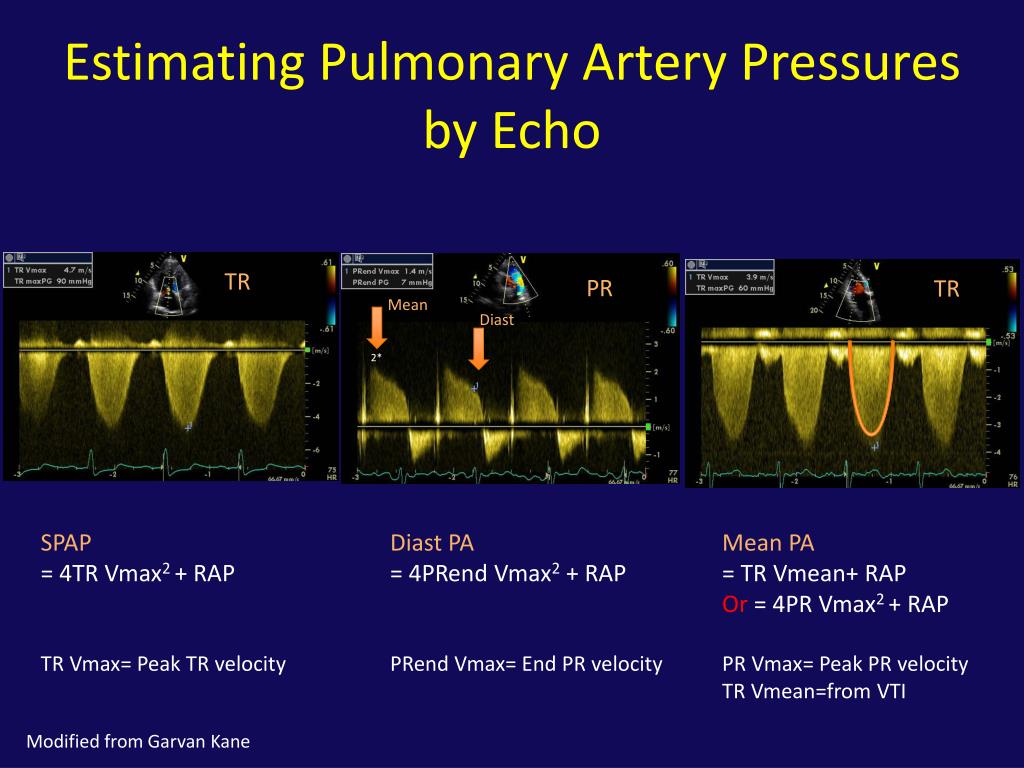 PPT - Role of the Echocardiogram in the Assessment of Pulmonary ...