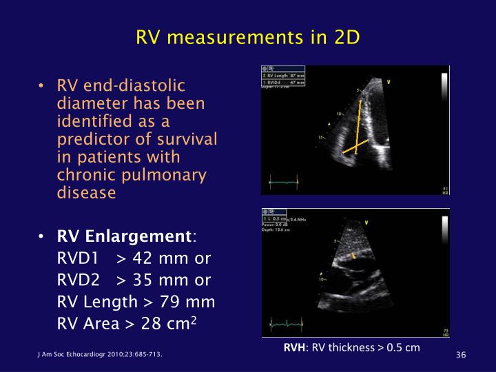 PPT - Role of the Echocardiogram in the Assessment of Pulmonary ...