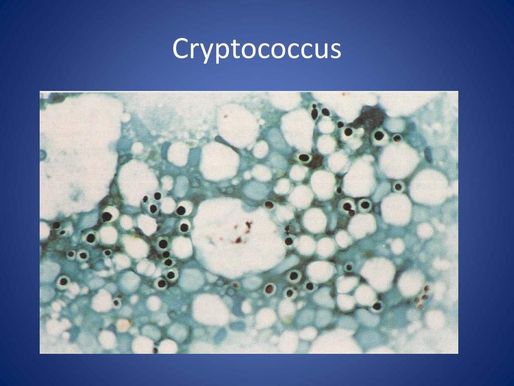 PPT - HIV and haematology PowerPoint Presentation, free download - ID ...