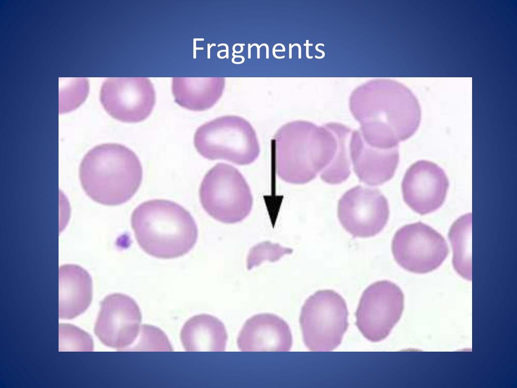 PPT - HIV and haematology PowerPoint Presentation, free download - ID ...