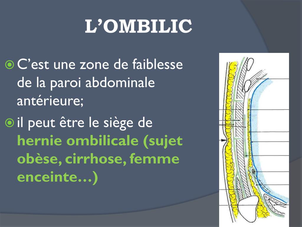 PPT - LA CAVITE ABDOMINALE ET SES PAROIS PowerPoint Presentation, free ...