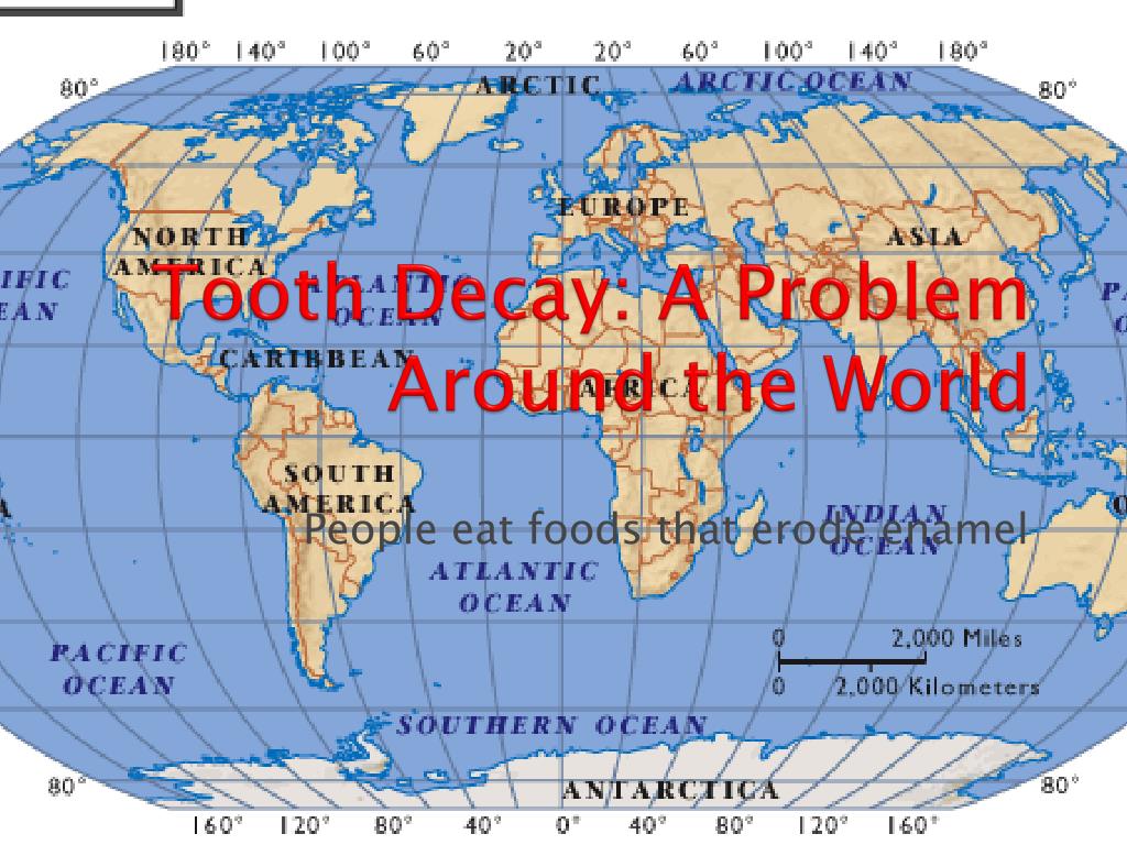 PPT - Fluoride Treatments: Good or Bad? PowerPoint Presentation, free ...