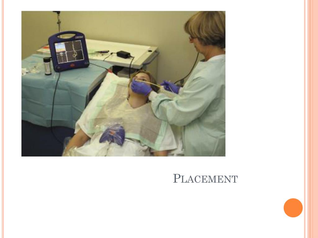 PPT - Feeding Tube Placements: Dietitian training and the Procedure ...