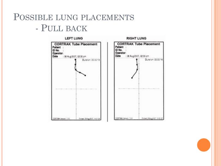 PPT - Feeding Tube Placements: Dietitian training and the Procedure ...