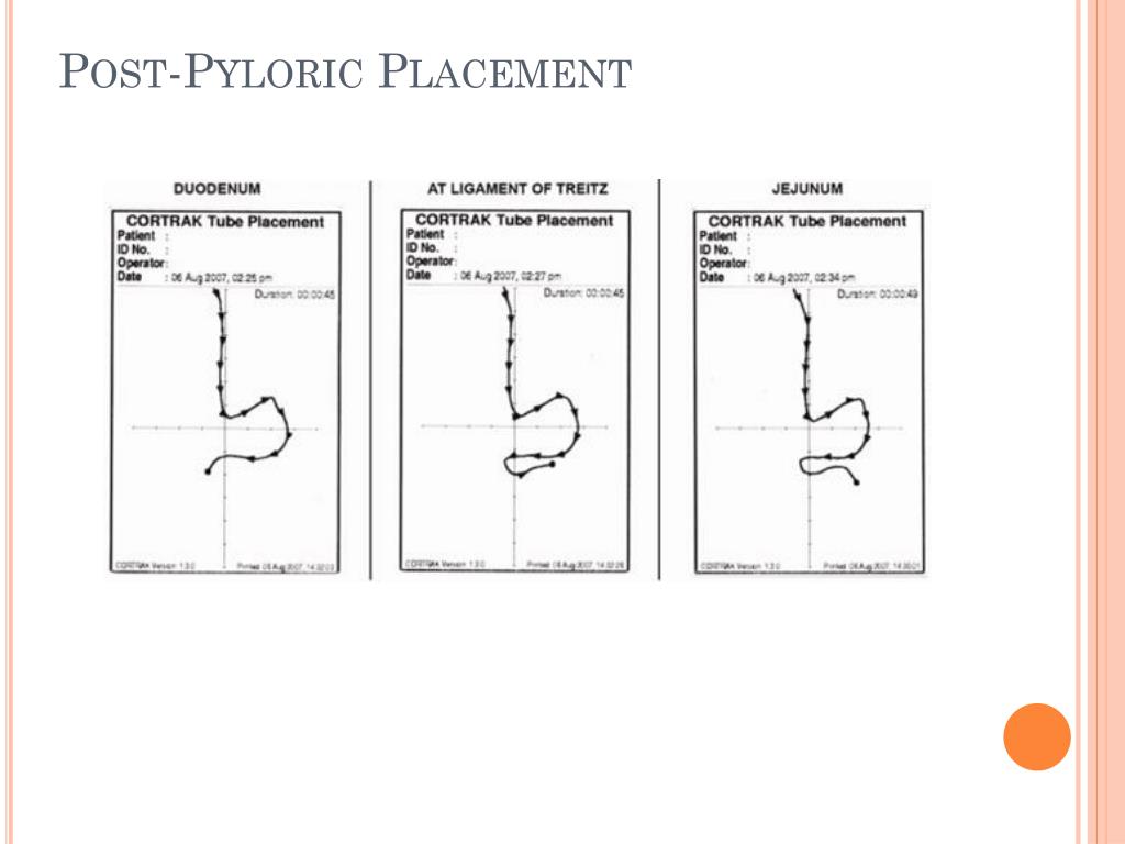 PPT - Feeding Tube Placements: Dietitian training and the Procedure ...