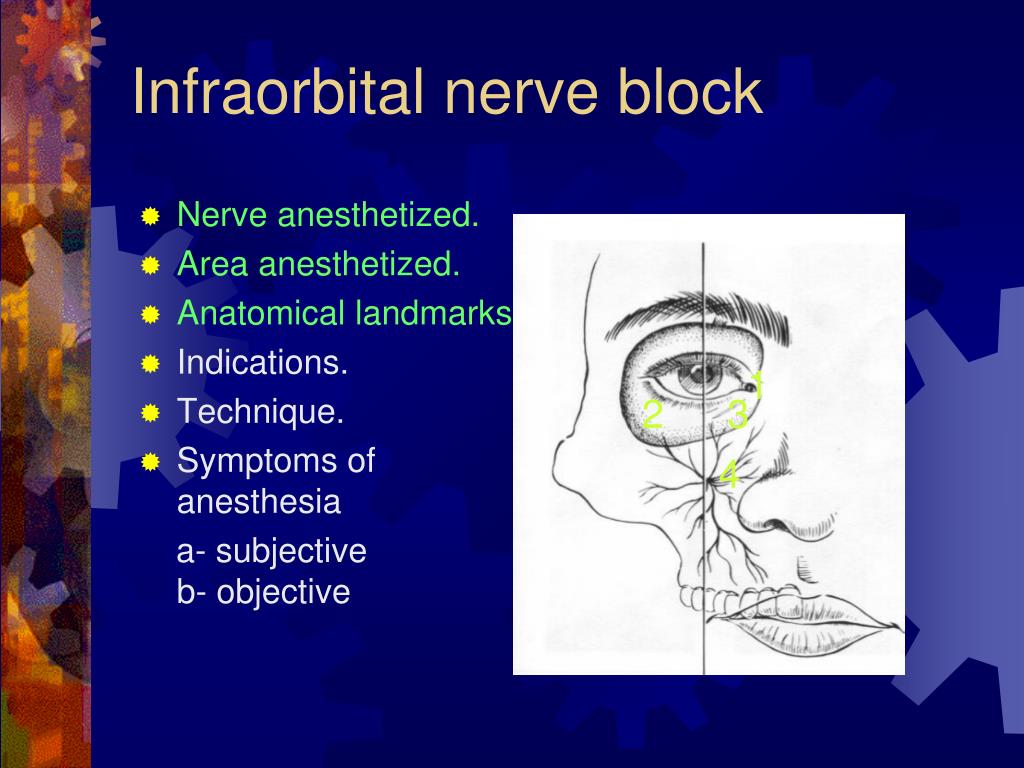 Intraoral Infraorbital Nerve Block Youtube